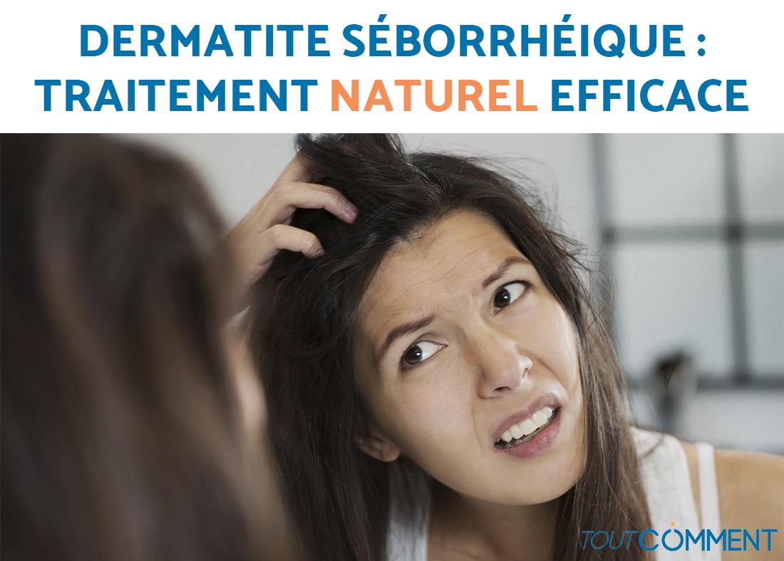 Dermatite séborrhéique : traitement naturel efficace
