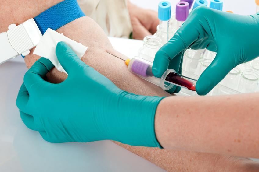 Comment soigner l'anisocytose - 5 étapes