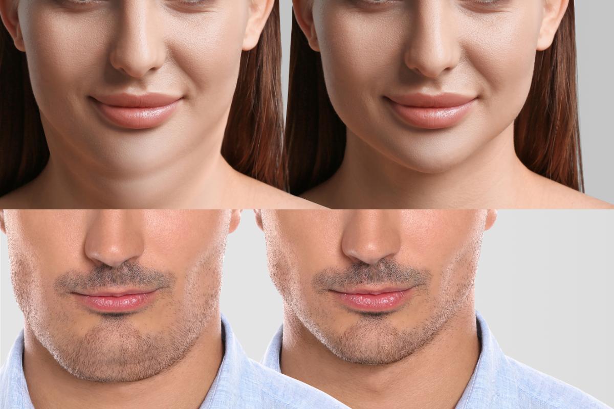 Qu'est-ce que le MEWING