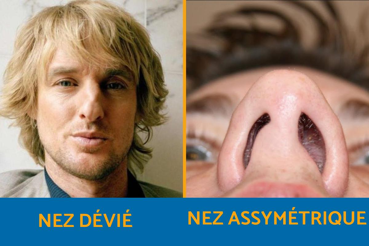 8 Différents TYPES de NEZ avec PHOTOS