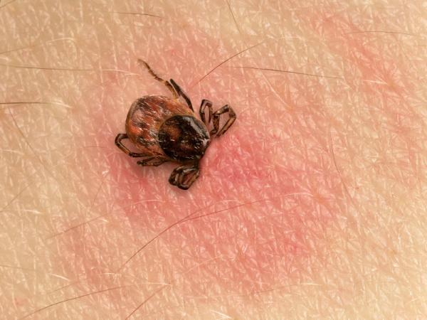Comment identifier les piqûres d'insectes